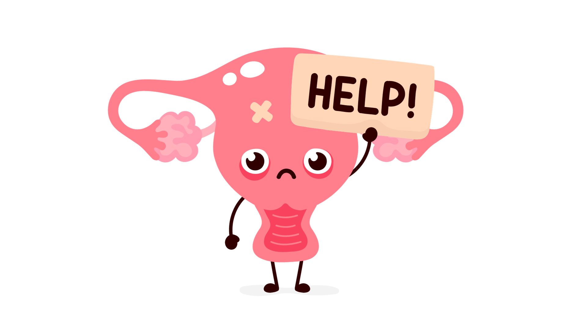 Module 35 – Uterine Inertia – Artemis Birth Academy